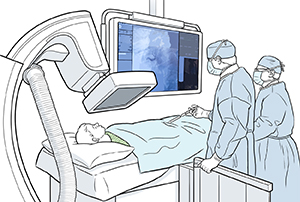 When Your Child Needs Diagnostic Cardiac Catheterization